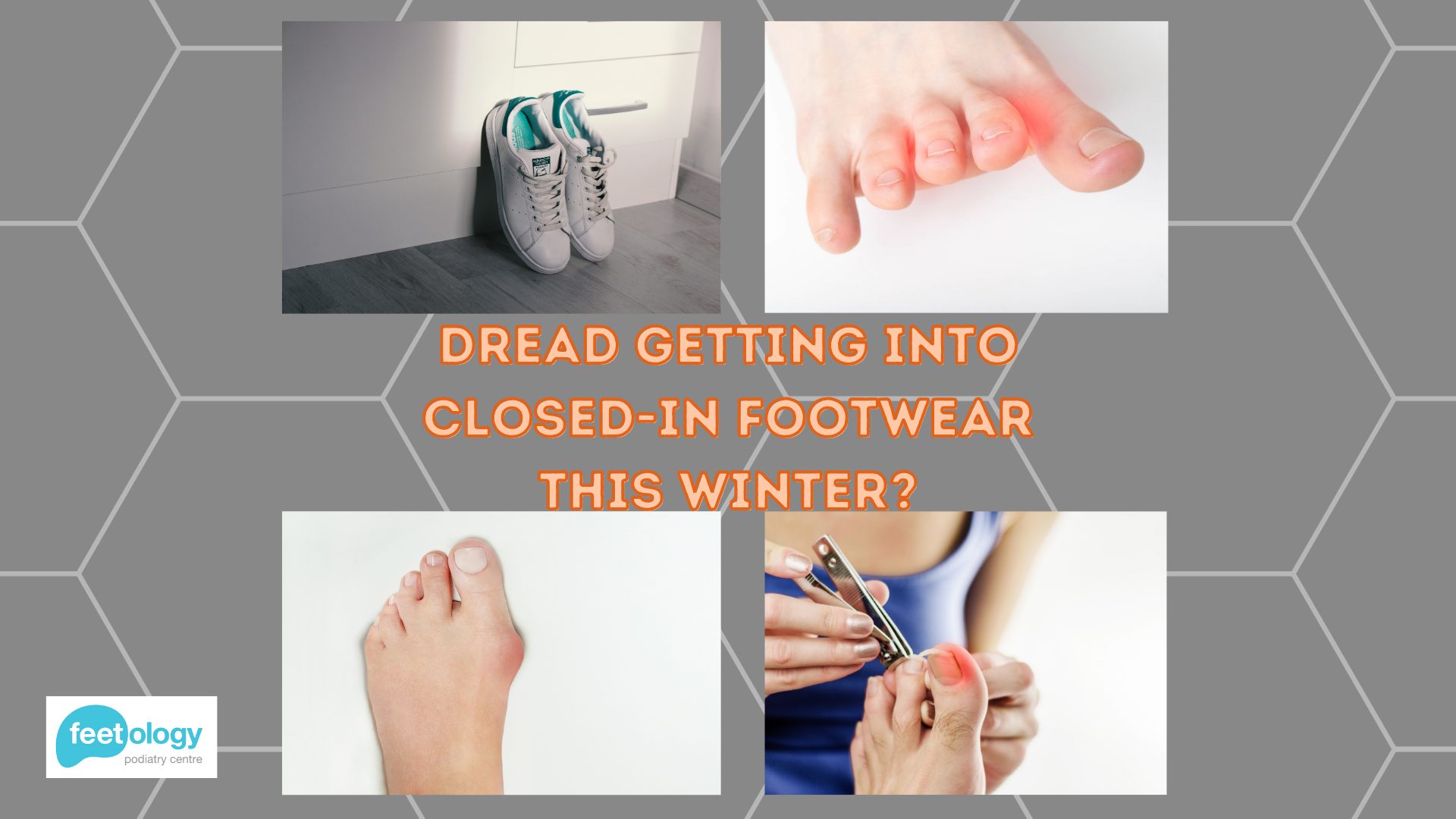 Do You Dread Getting Into Closed-In Footwear This Winter? - Feetology ...